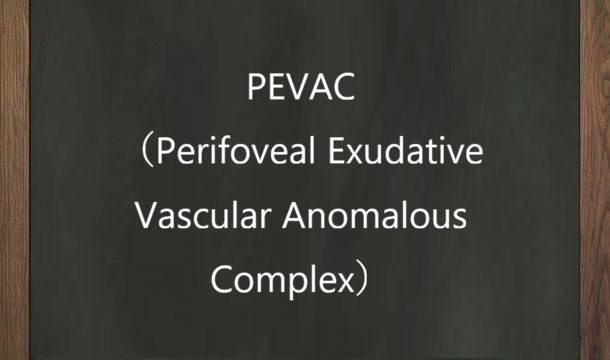 PEVAC（Perifoveal Exudative Vascular Anomalous Complex） | オンライン眼科